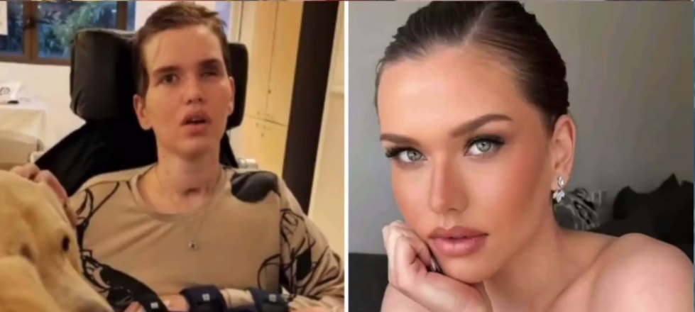 Young woman left wheelchair bound after being shot in the head during ...